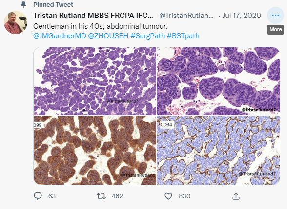 Educating Via Twitter - A 'perfect Platform' For Pathology | NSW Health ...